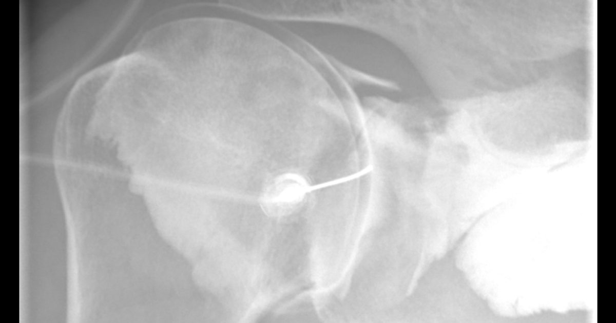 Interventional radiology | Radiology SA